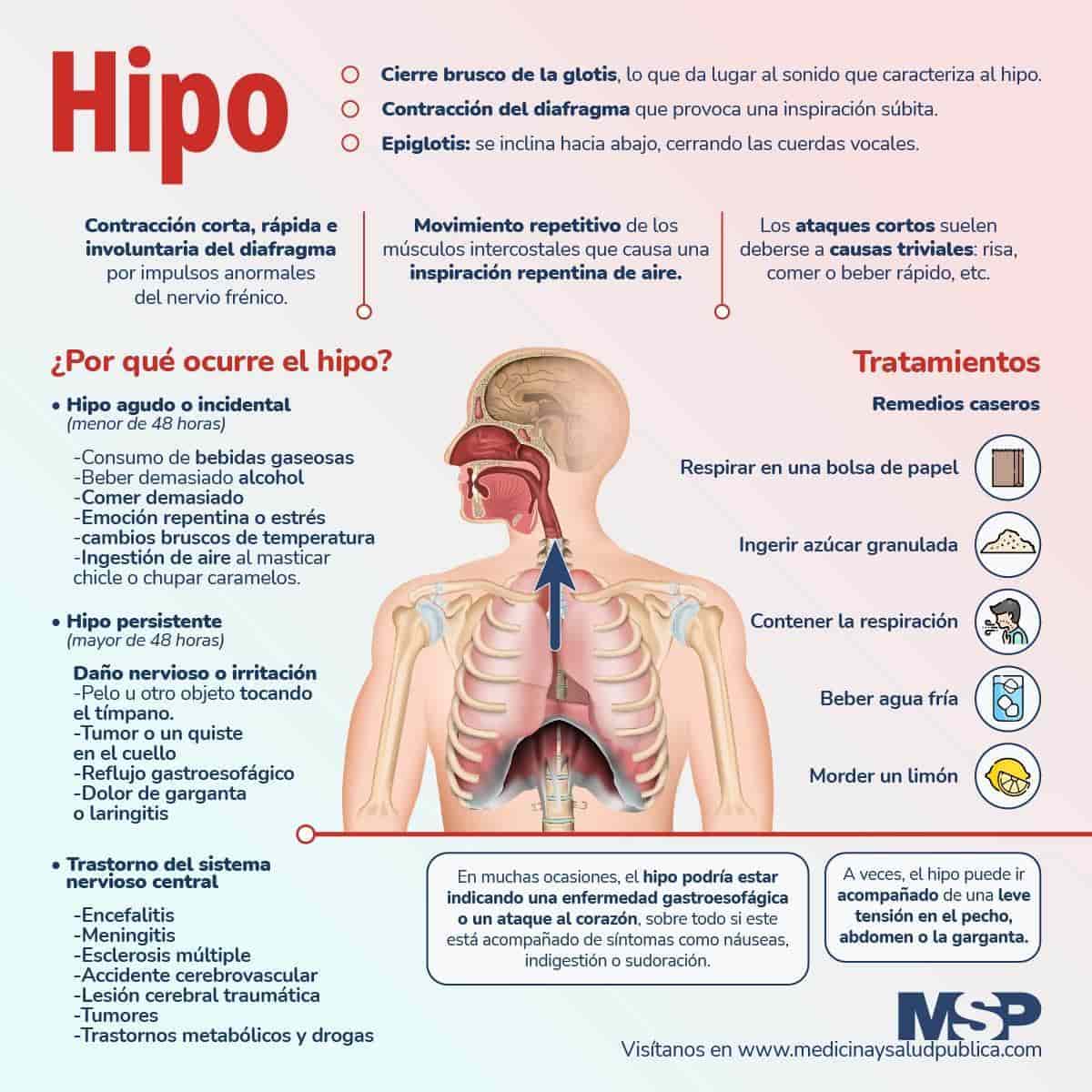 Hipo - Infografía