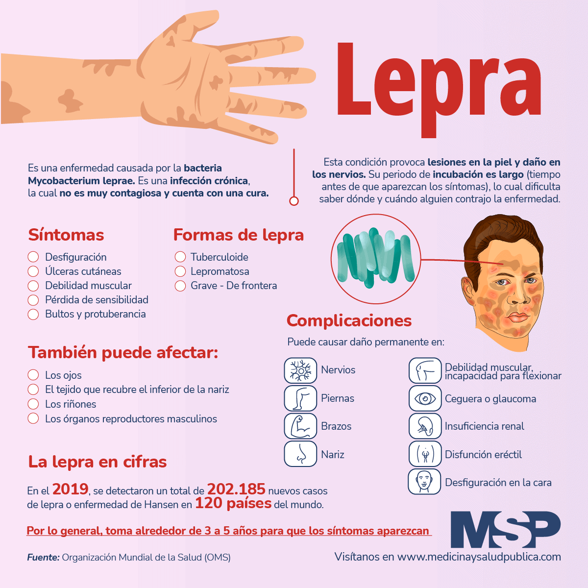 Lepra - Infografía