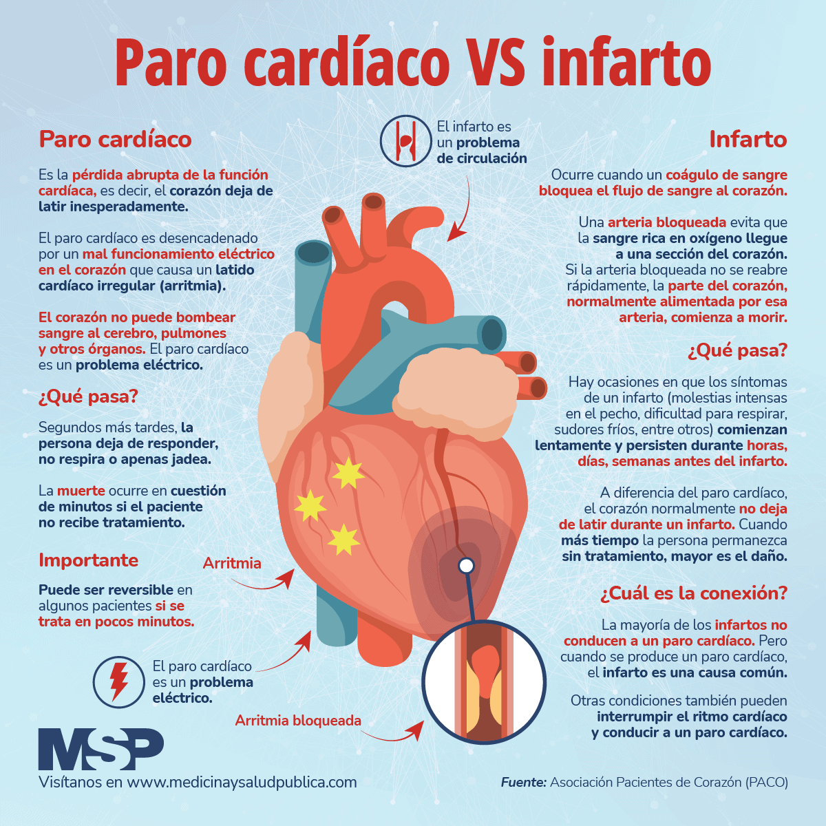 Paro cardíaco vs Infarto - Infografía