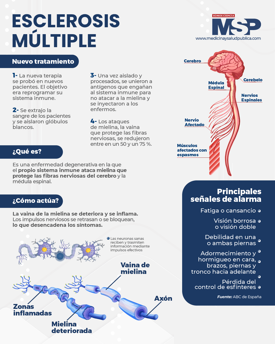 Esclerosis Multiple - Infografías