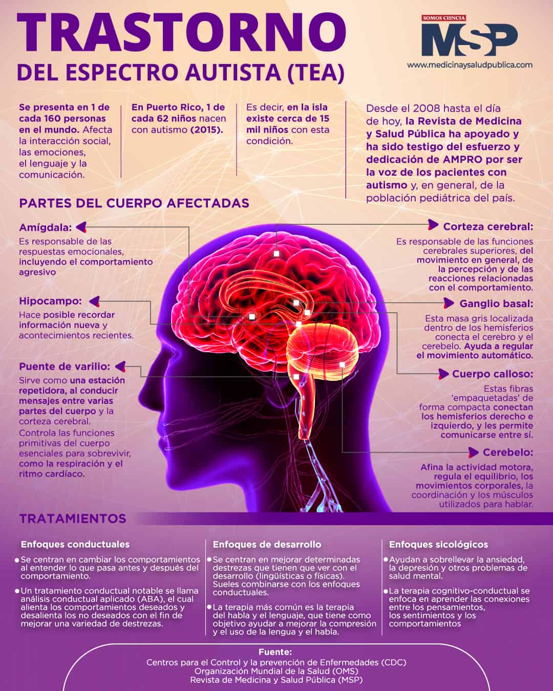Transtorno del espectro autista - Infografía
