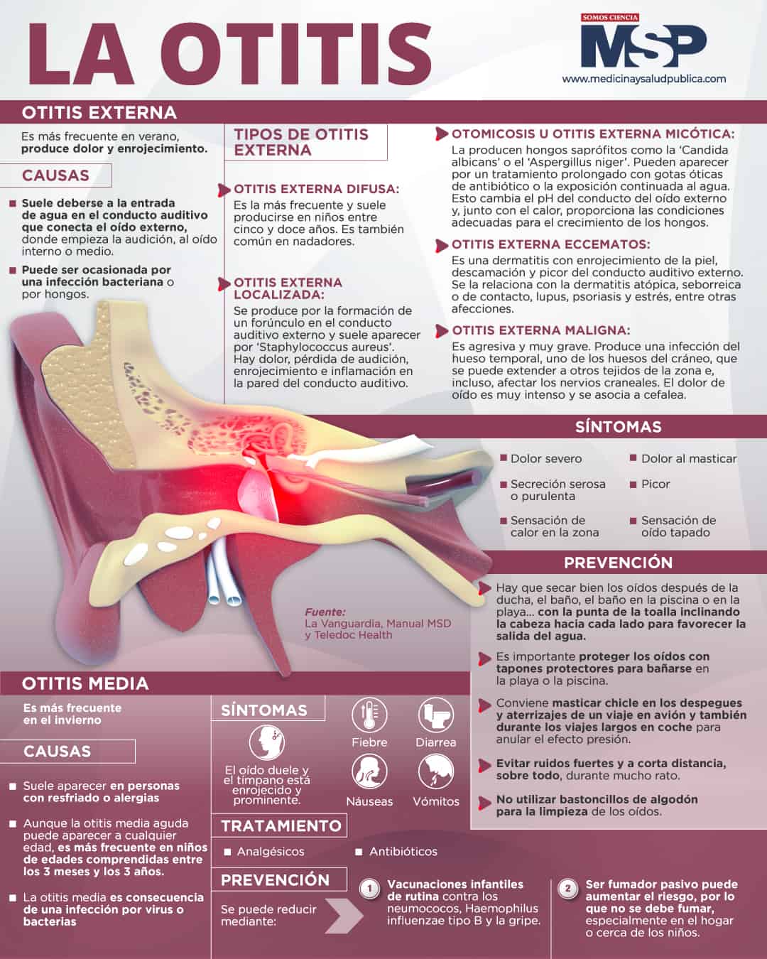 La otitis - Infografía