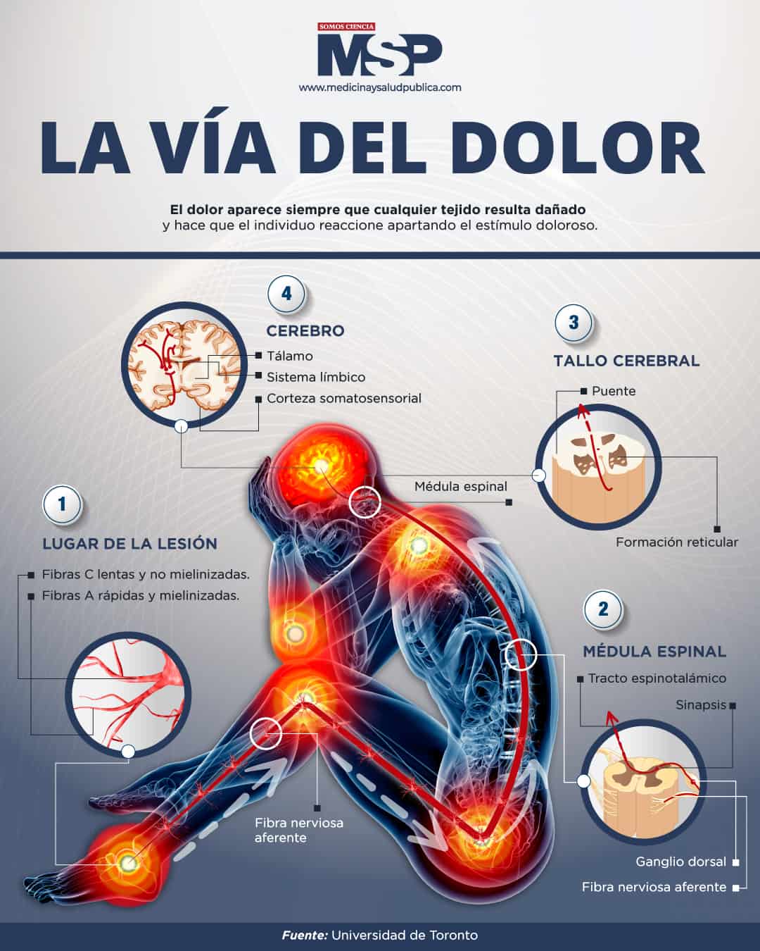 La vía del dolor - Infografía
