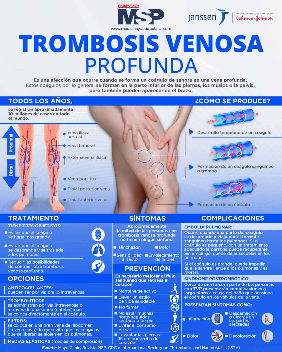 Trombosis Venosa Profunda - Infografía