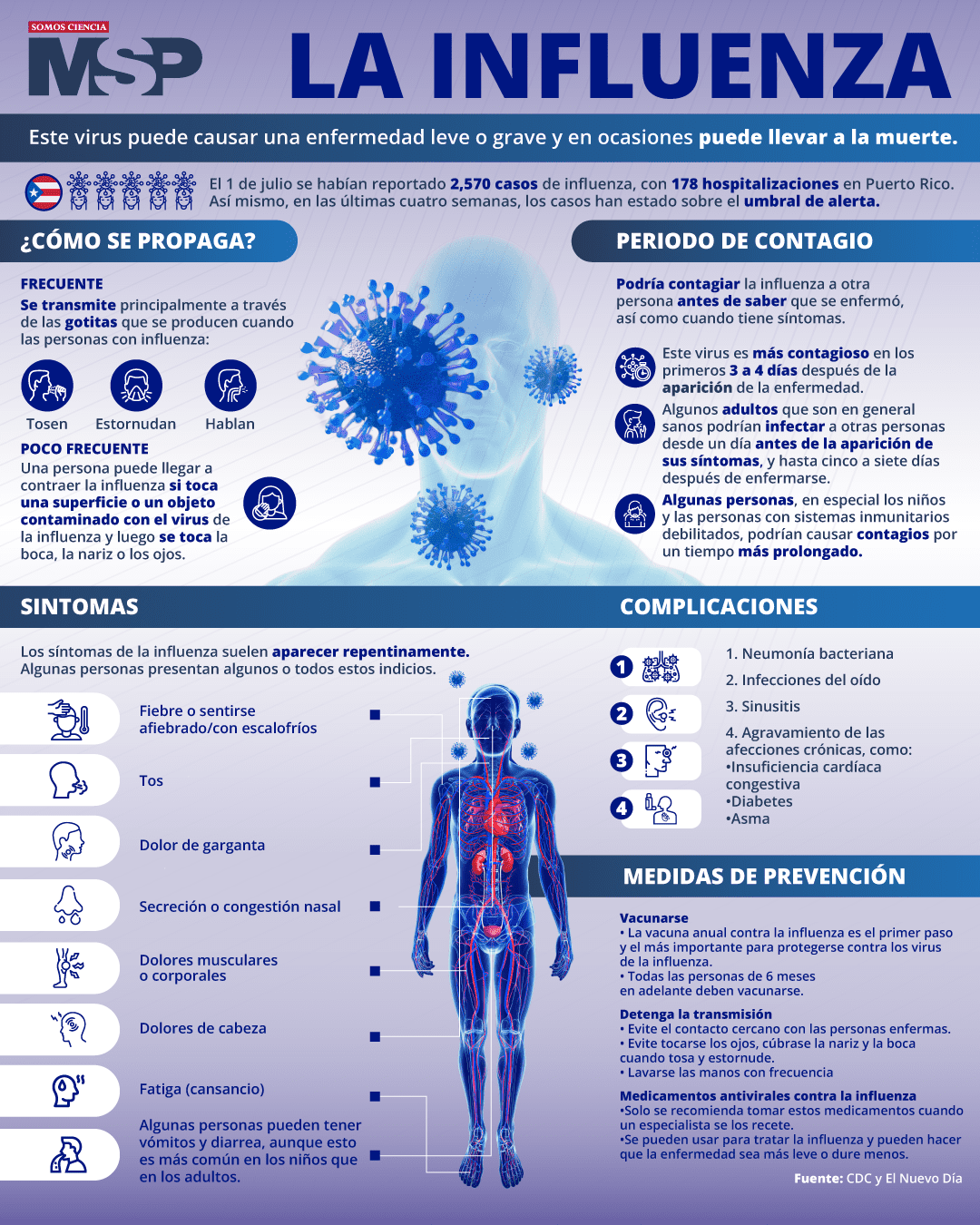 La Influenza - Infografía