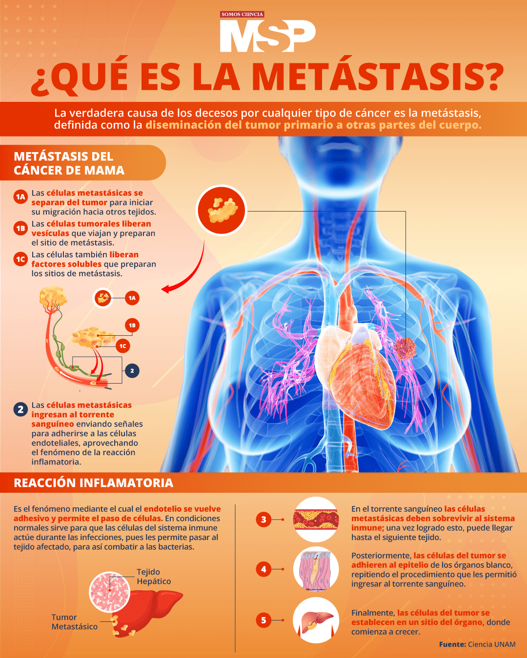 ¿Qué es la metástasis? - Infografía