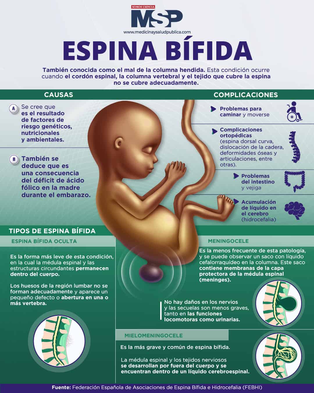 Espina bífida - Infografía