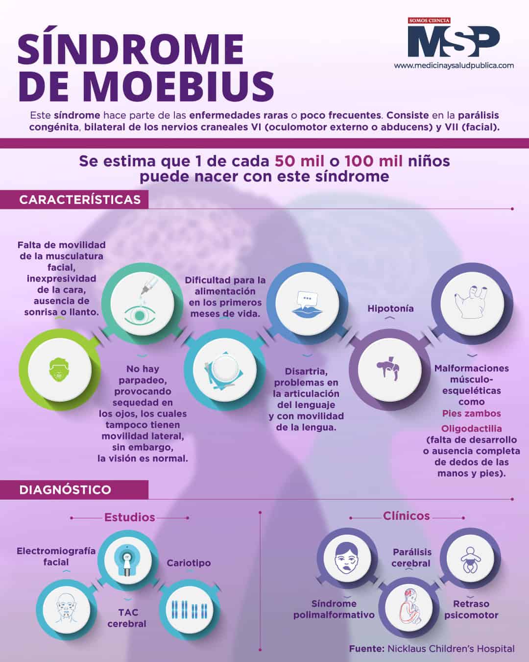 Síndrome de Moebius - Infografía