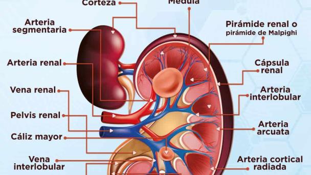 Anatomía Del Riñón En Herradura Frente A La Anatomía Del Riñón Normal