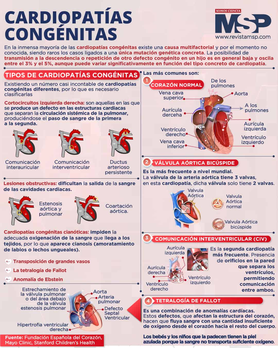 Cardiopatía Infográfica
