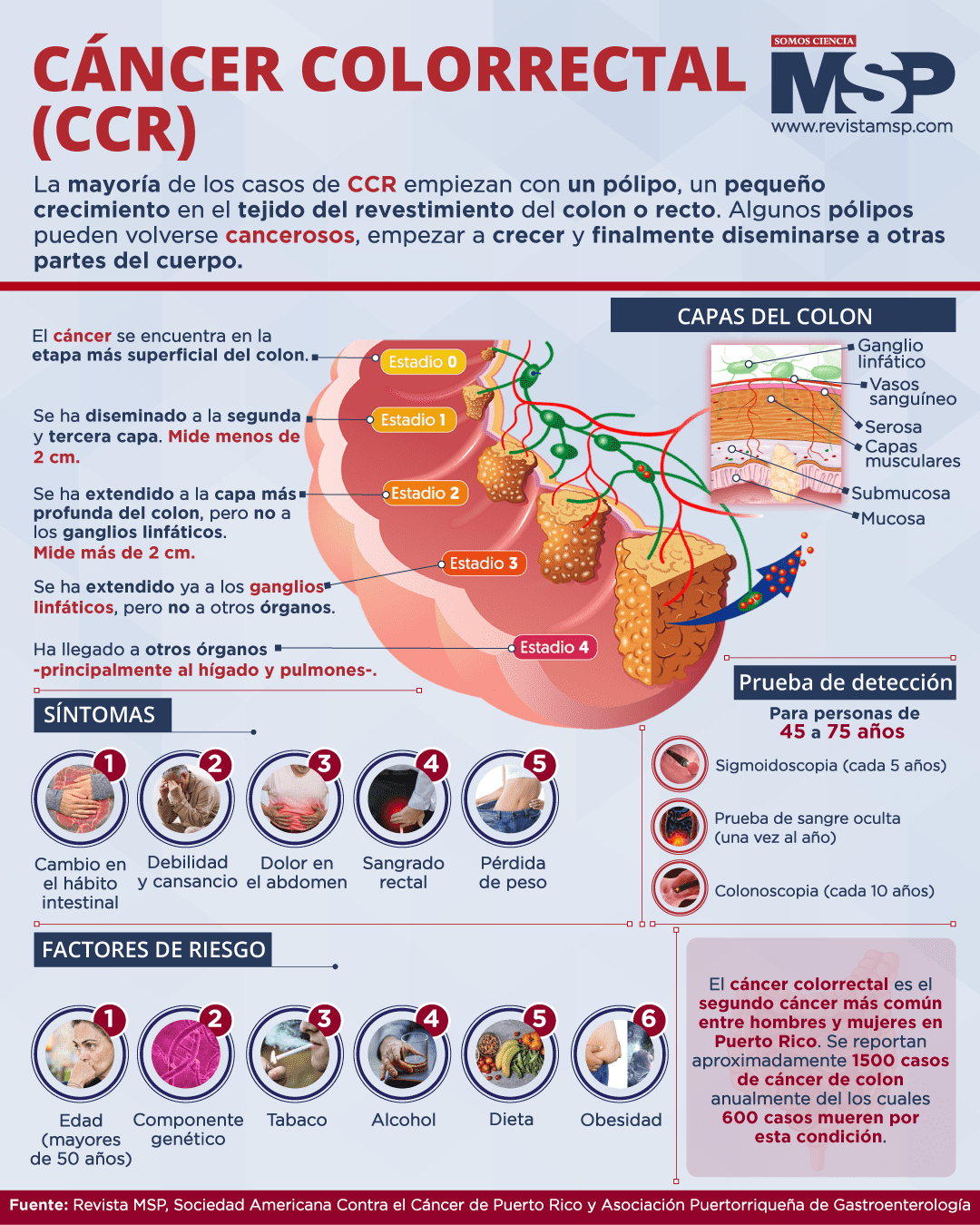 Cáncer colorrectal - Infografía