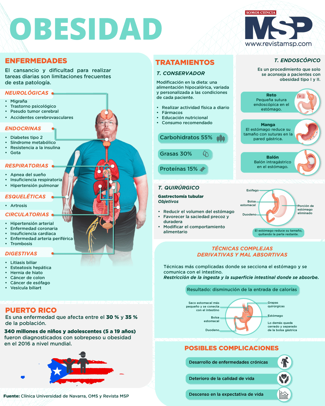Obesidad - infografía