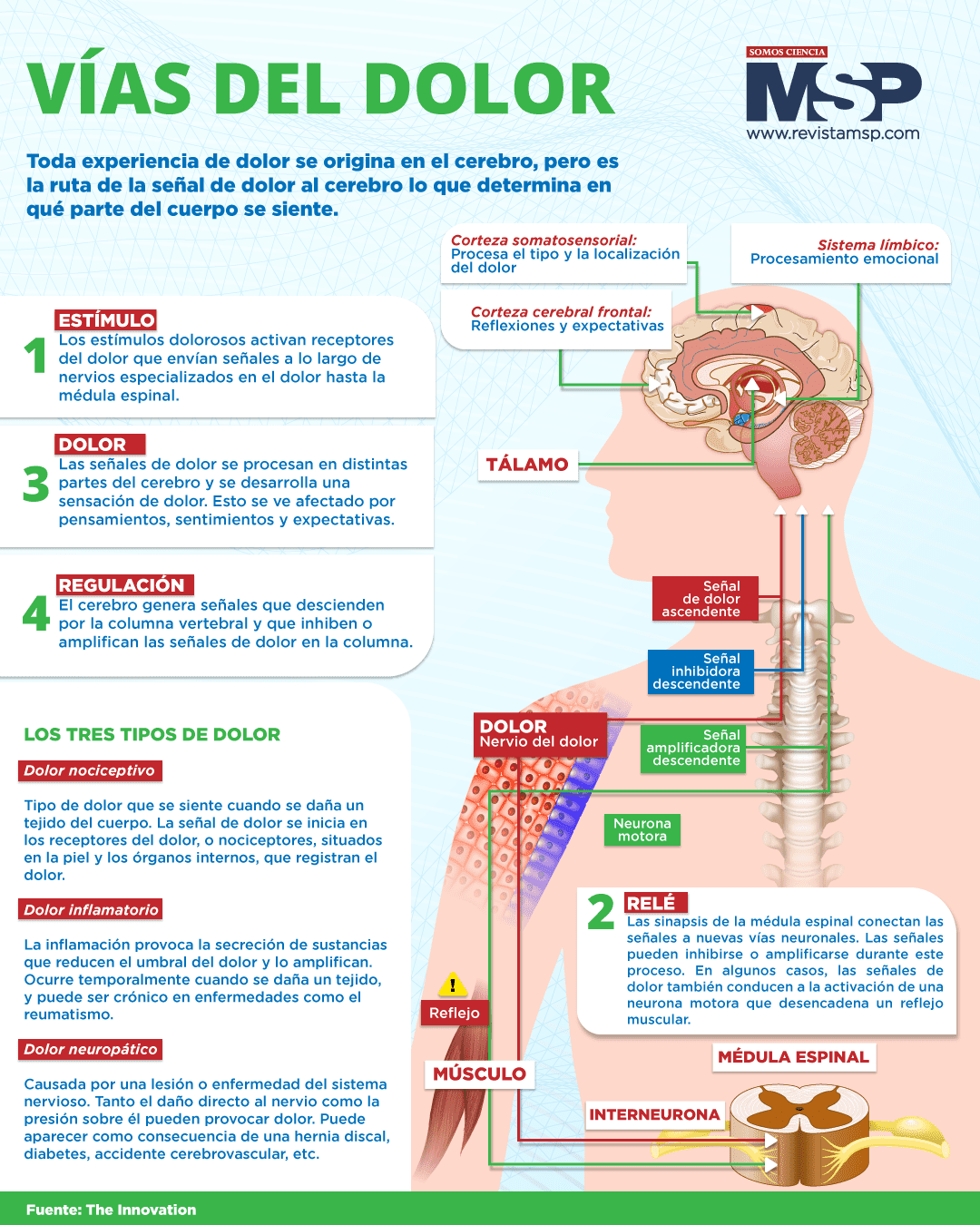 Vías del dolor - Infografía