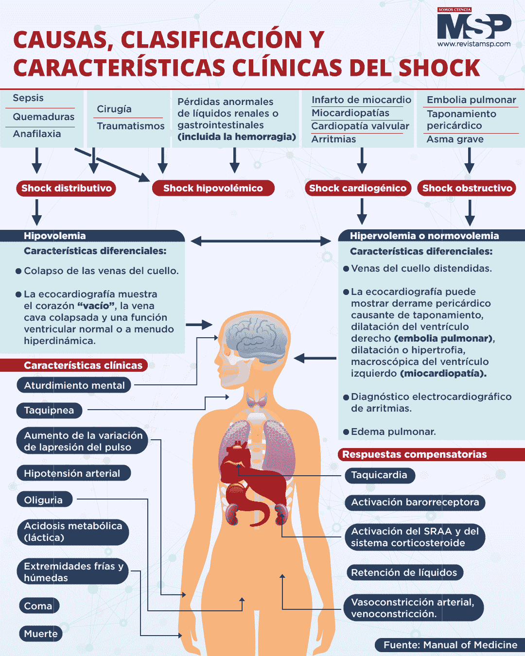Causas, clasificación y características clínicas del shock - Infografía