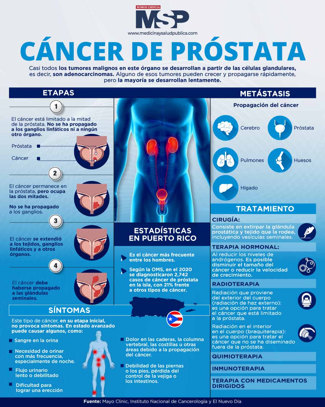 Cancer De Prostata Causas Bayer México Presenta Nuevo Tratamiento