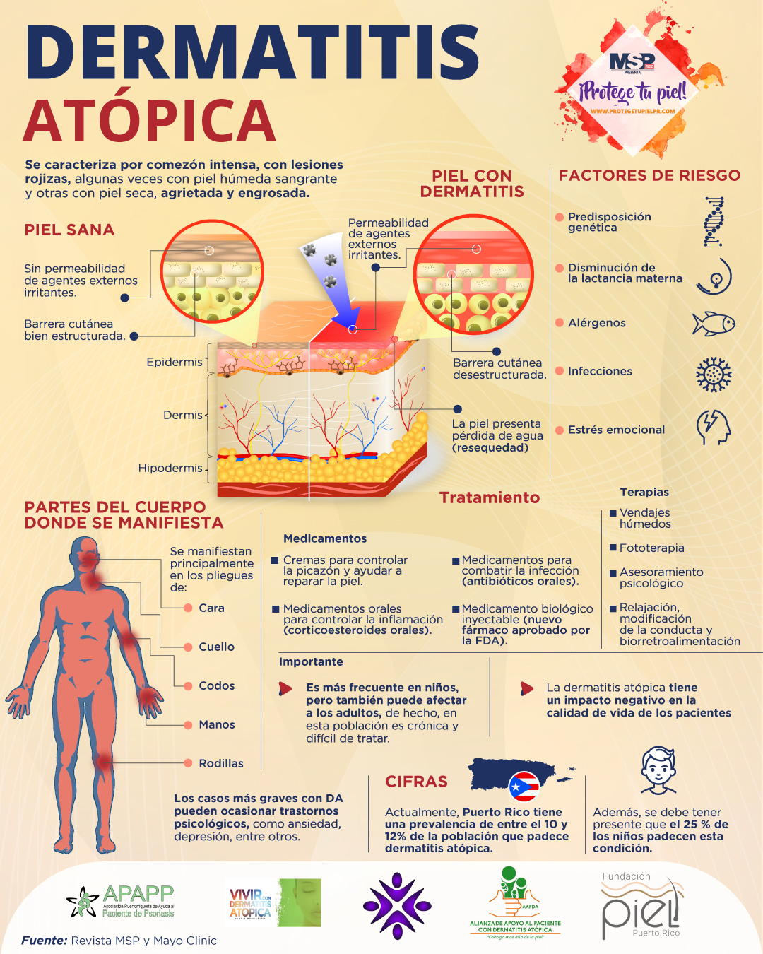 Dermatitis atópica