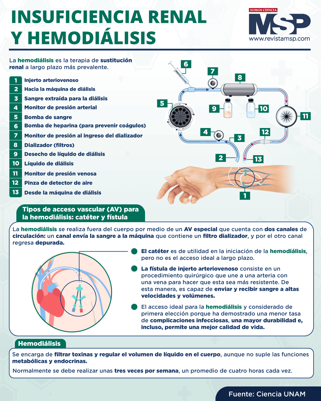 Insuficiencia renal y hemodiálisis