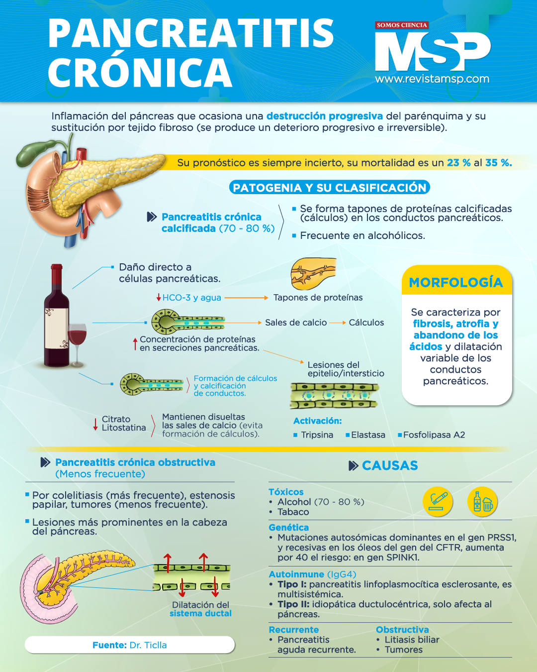 Pancreatitis crónica