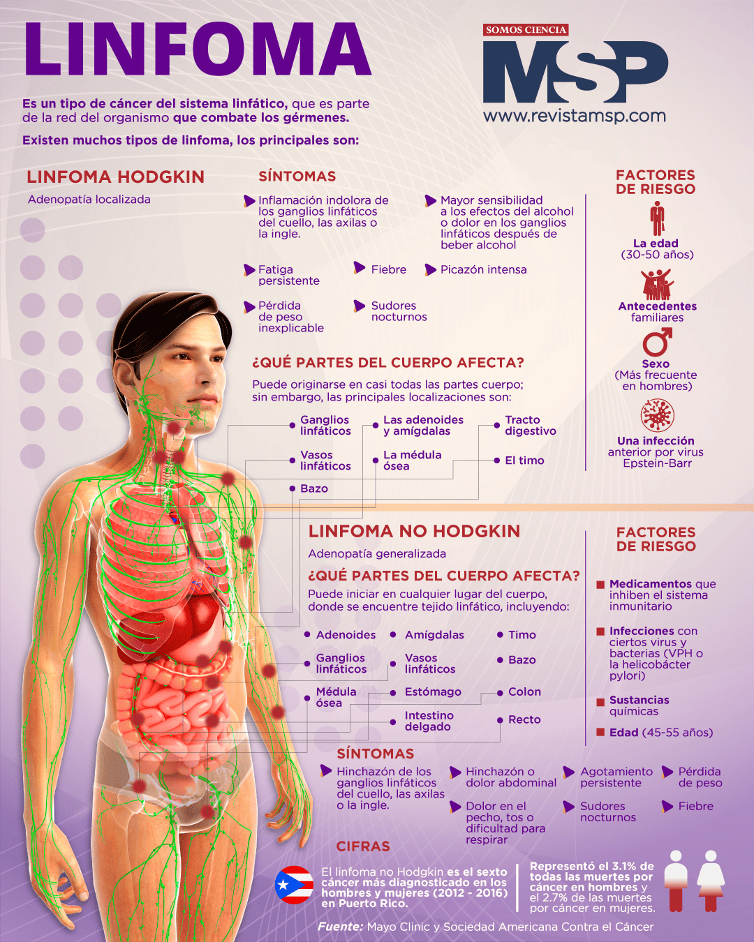 Linfoma - Infografía