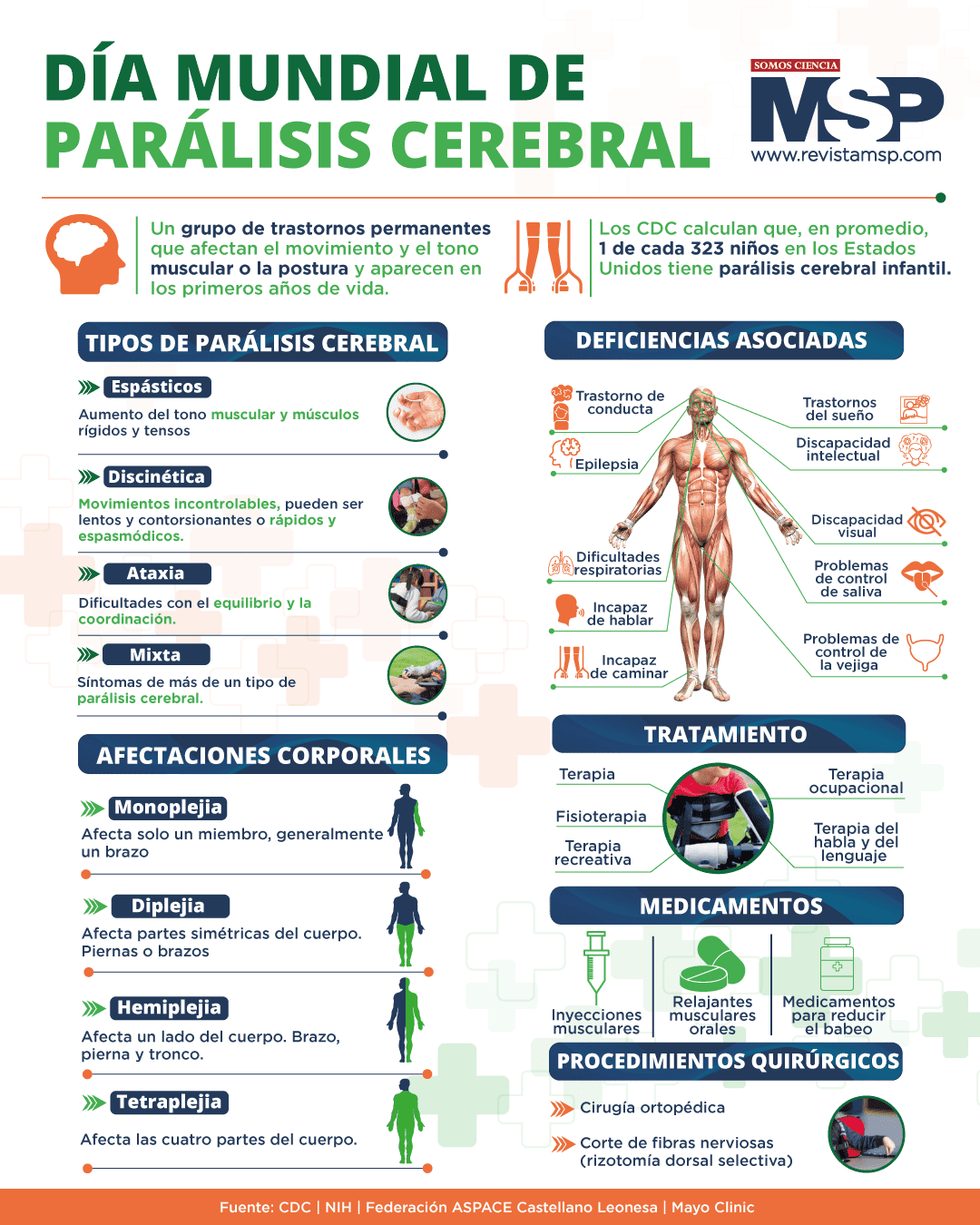 Que Es Paralisis Su Definicion Y Significado 2021 Día Mundial De La