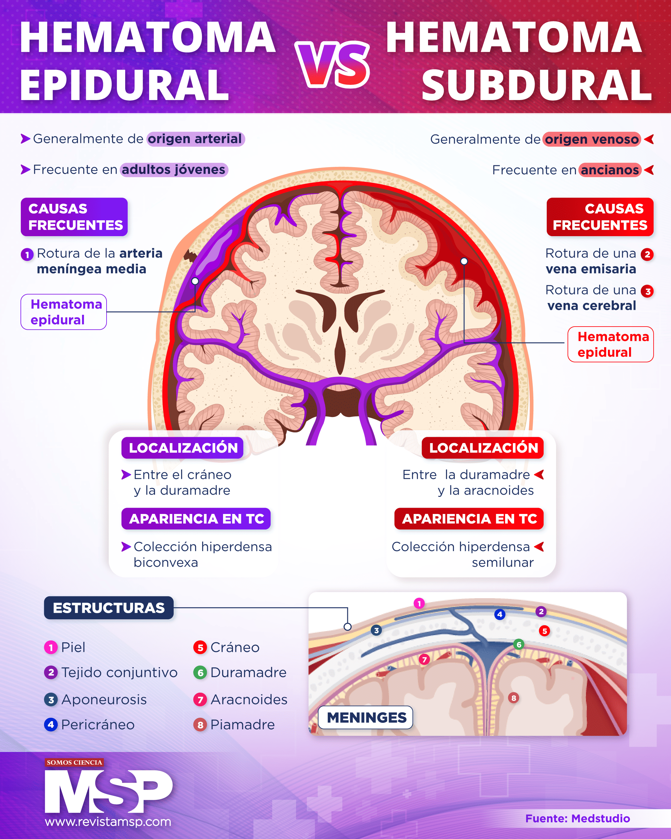 Hematoma epidural VS hematoma subdural