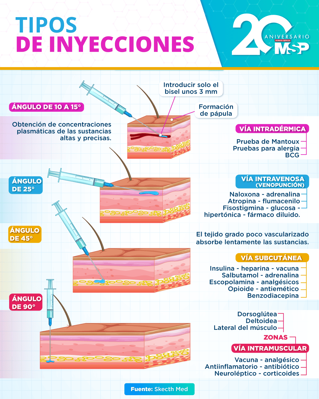 Tipos de inyecciones