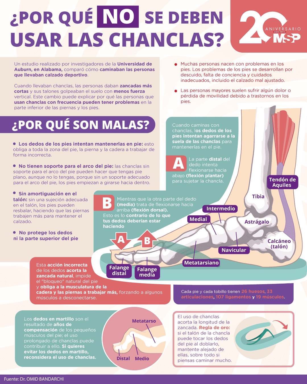 ¿Por qué no se deben usar las chanclas?