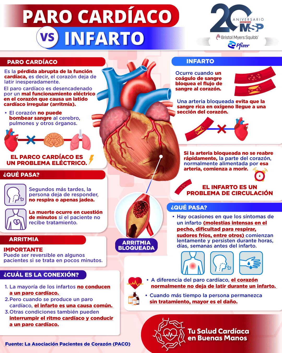 Paro cardíaco VS infarto
