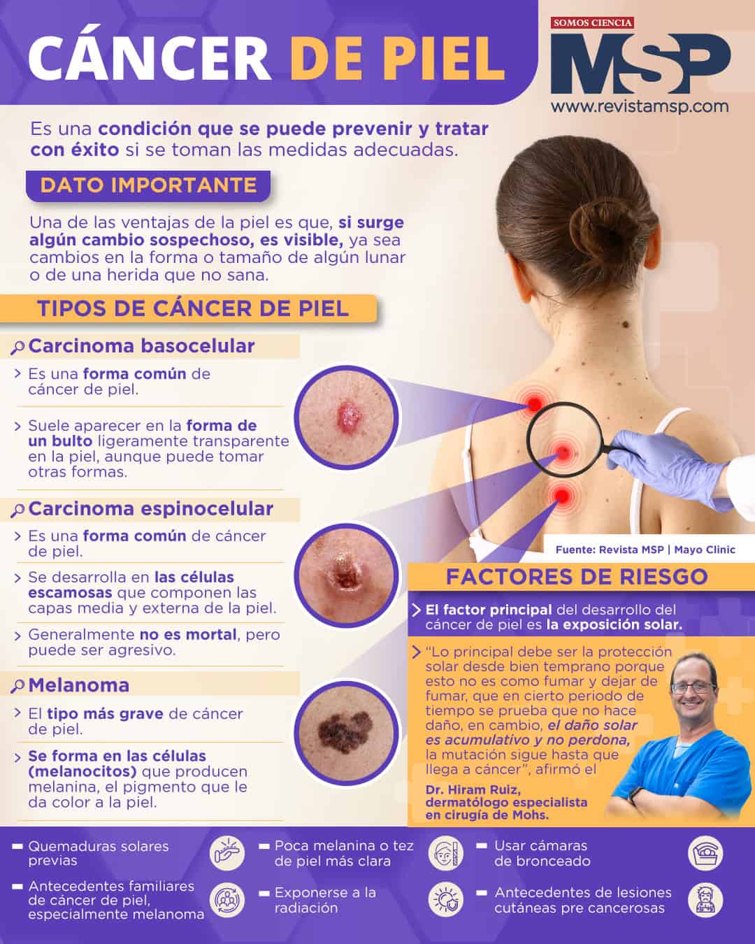 Cáncer de piel