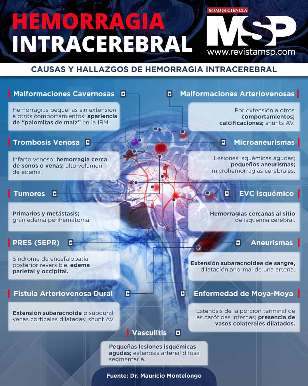 Hemorragia intracraneal