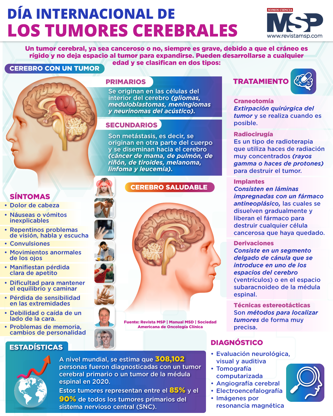 Día internacional de los tumores cerebrales