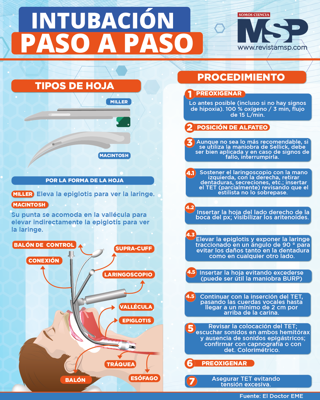 Intubación paso a paso