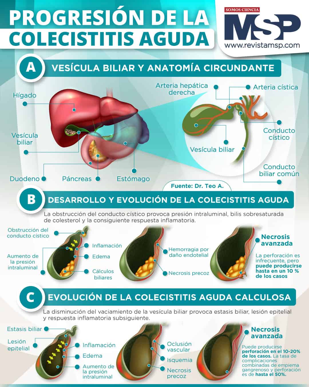 Progresión de la colecistitis aguda