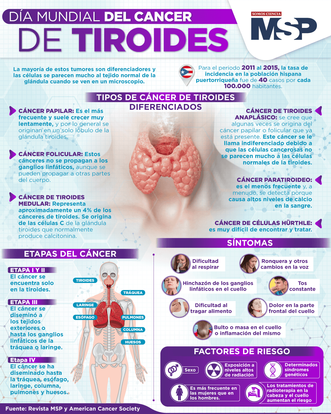 Cáncer de tiroides