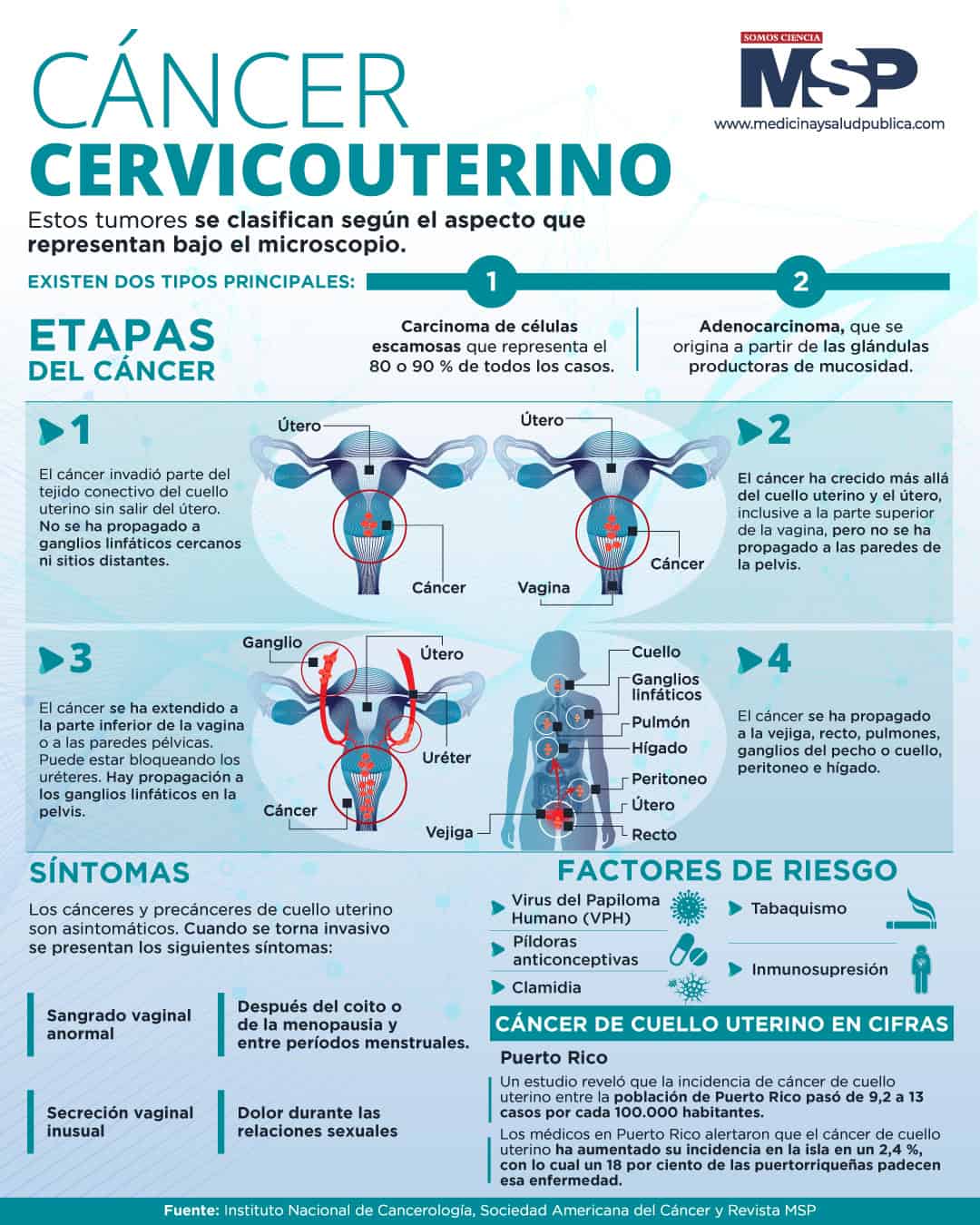 Cáncer Cervical