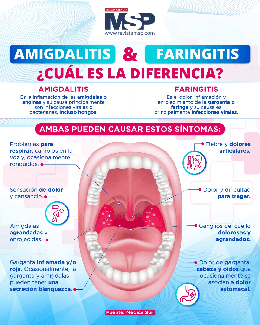 AMIGDALITIS Y FARINGITIS