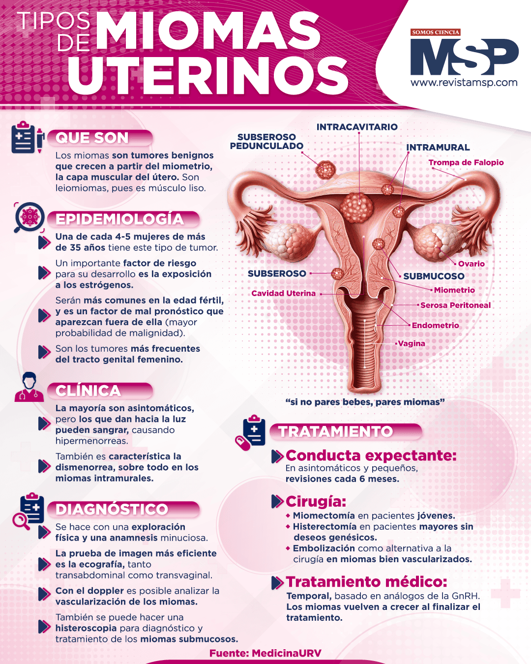 TIPOS DE MIOMAS UTERINOS