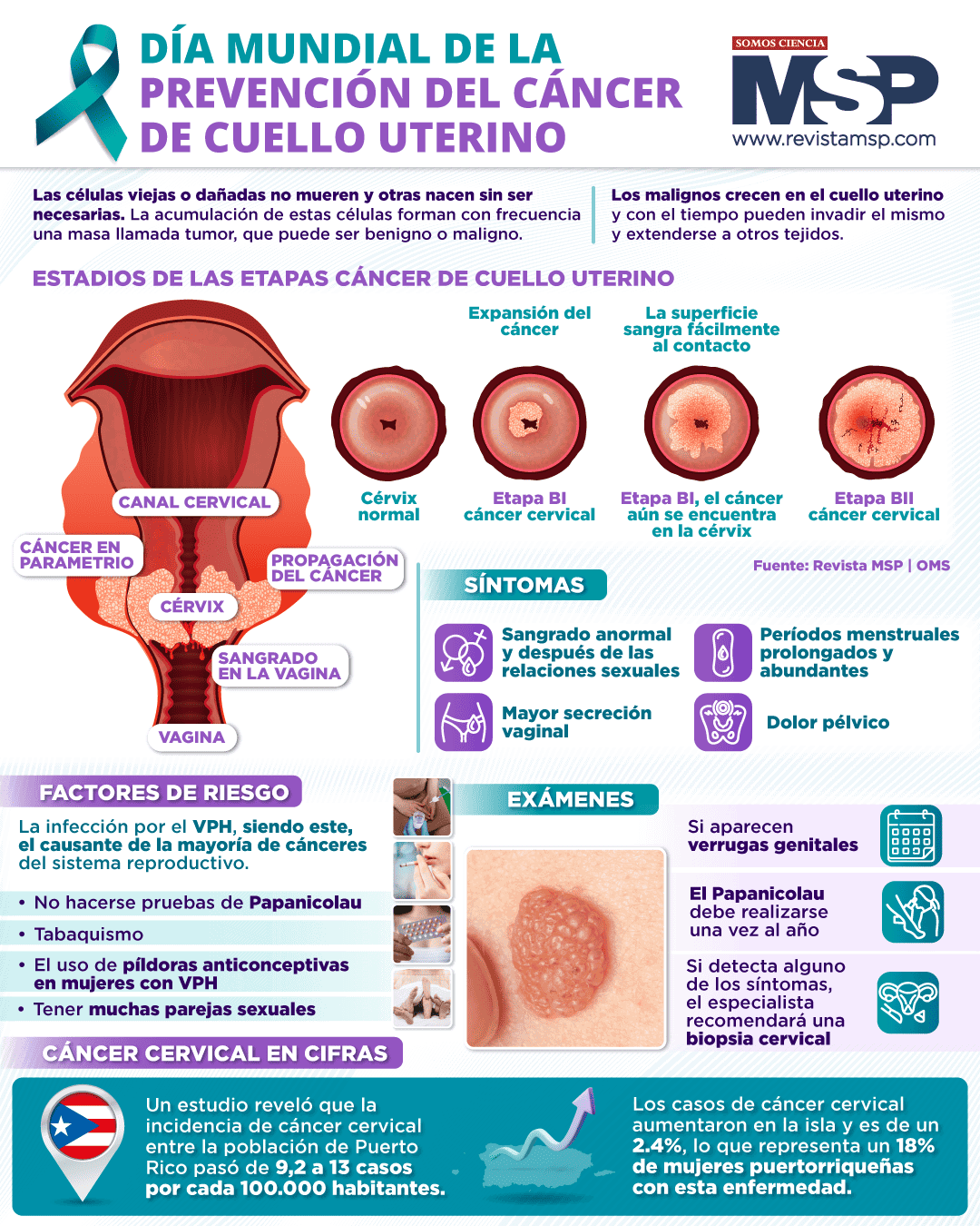 CÁNCER DE CUELLO UTERINO