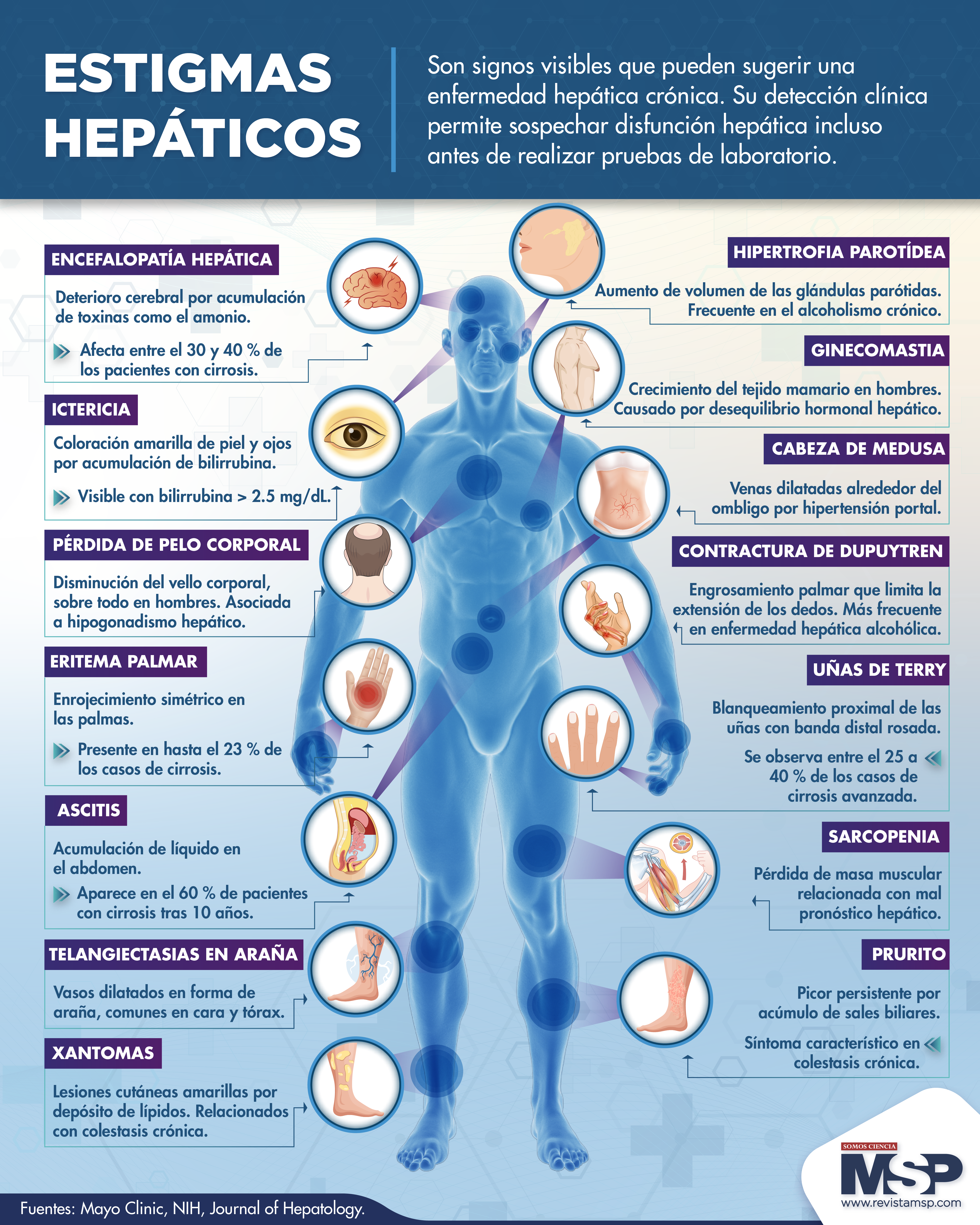 ESTIGMAS HEPÁTICOS
